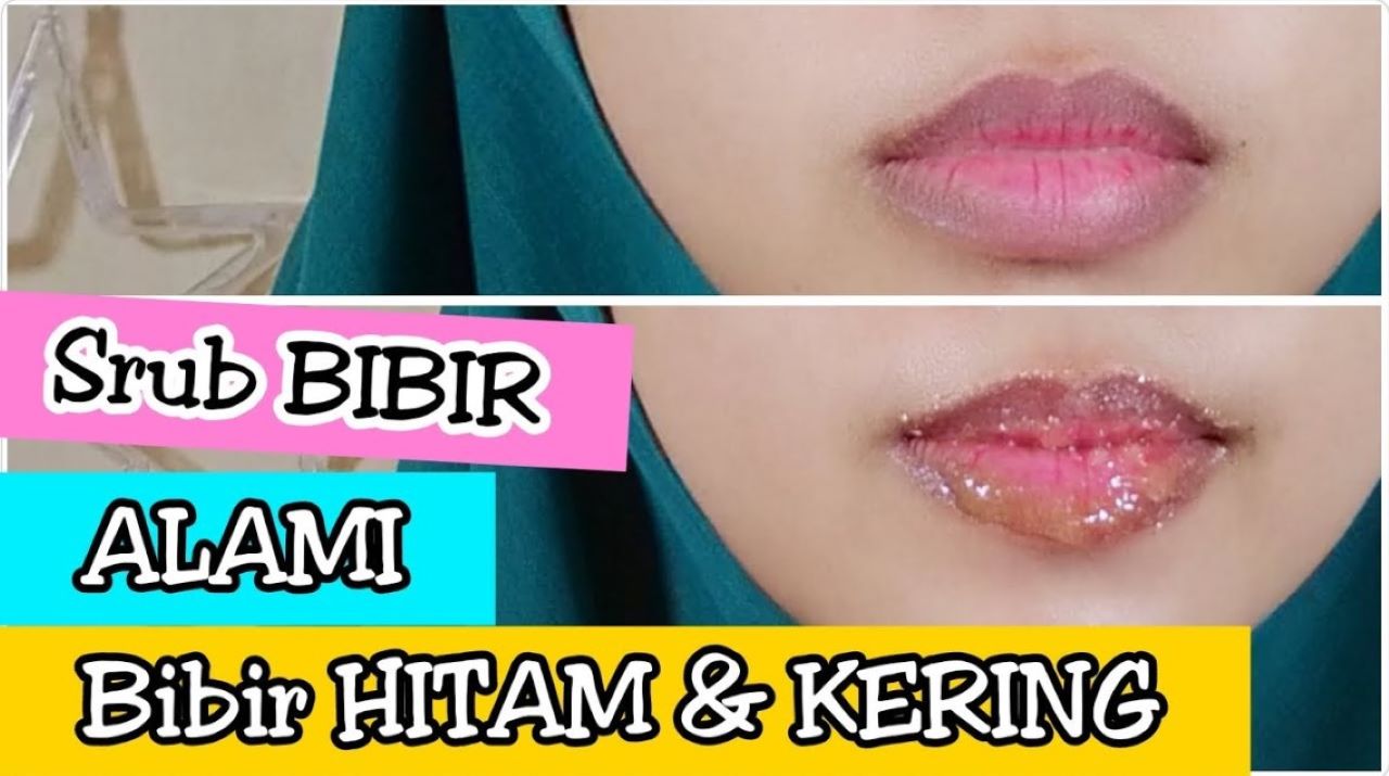 Cara Mengatasi Bibir Kering Saat Puasa, Cukup Gunakan Racikan dari 2 Bahan Alami Ini Saja