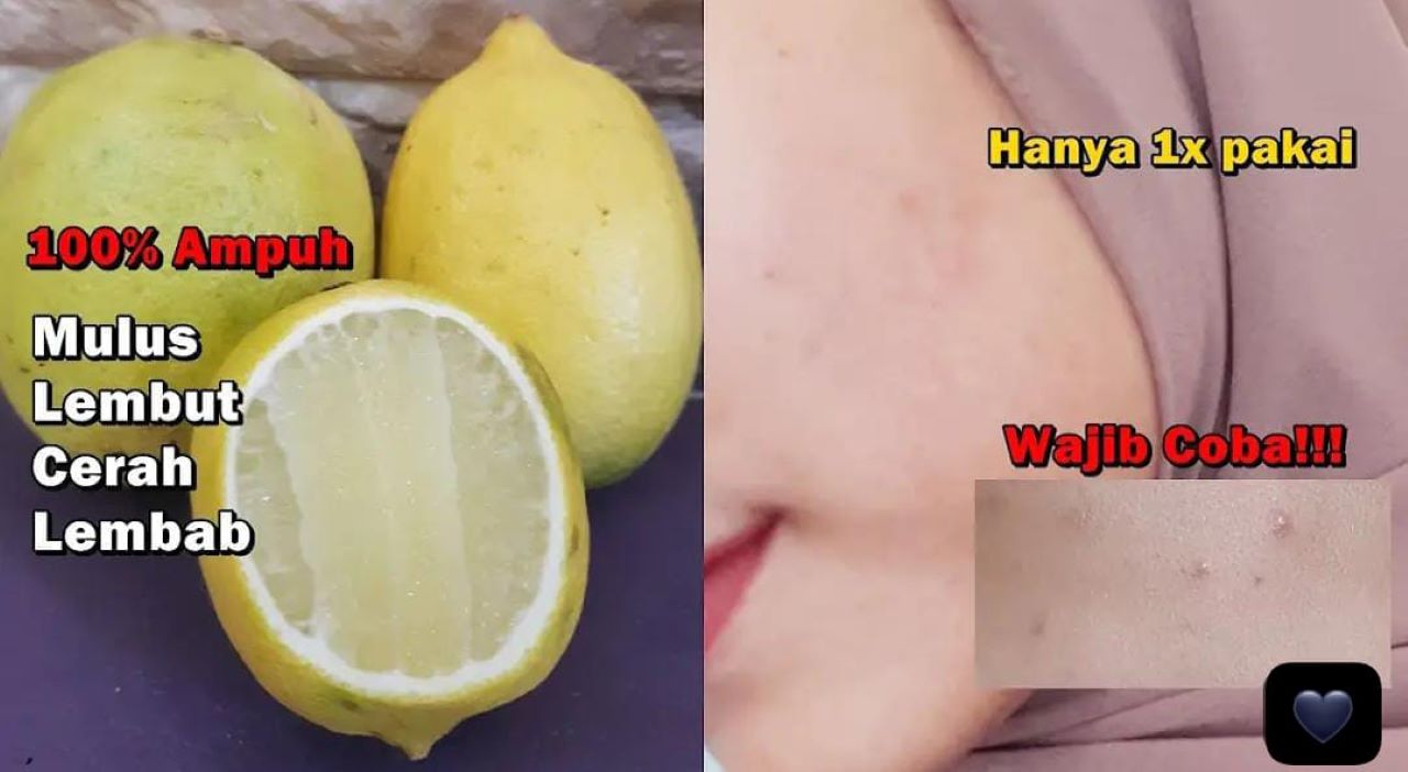 DIY Masker Lemon Pengelupas Flek Hitam dan Pengecil Pori-Pori, Begini 3 ...