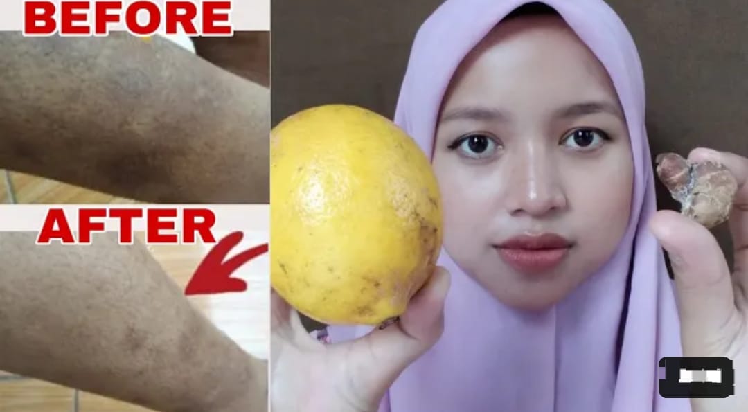 3 Cara Menghilangkan Bekas Hitam di Kaki Secara Alami Dalam 1 Malam ...