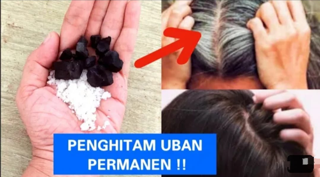 4 Cara Menghitamkan Rambut Beruban Secara Alami Dalam Semalam, Rahasia Rambut Hitam Permanen ...
