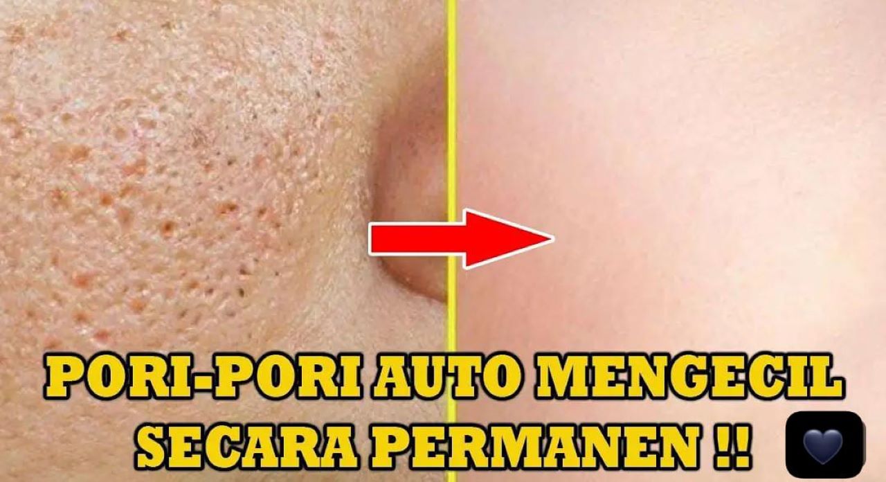 4 Bahan Dapur Pengecil Pori-Pori yang Terbuka, Begini Cara Mudah ...