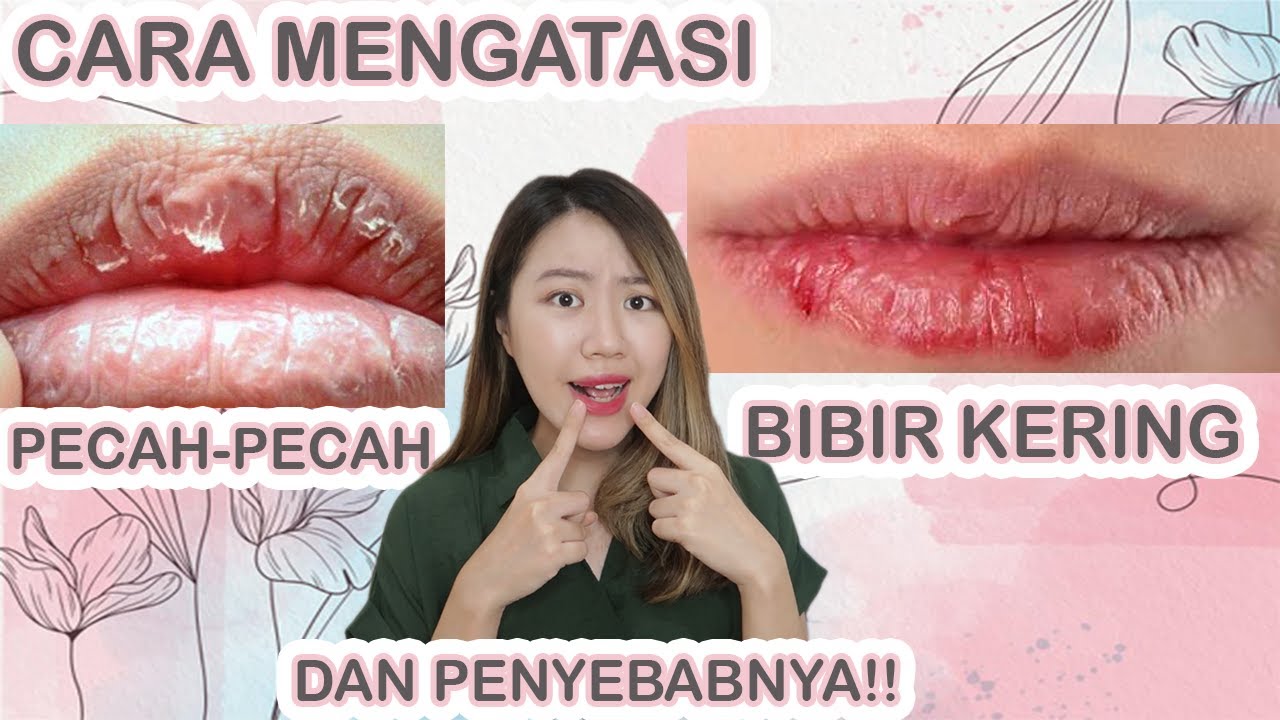 3 Cara Mengatasi Bibir Kering Saat Puasa Secara Alami, Bibir Auto Lembap dan Kenyal Sepanjang Hari!