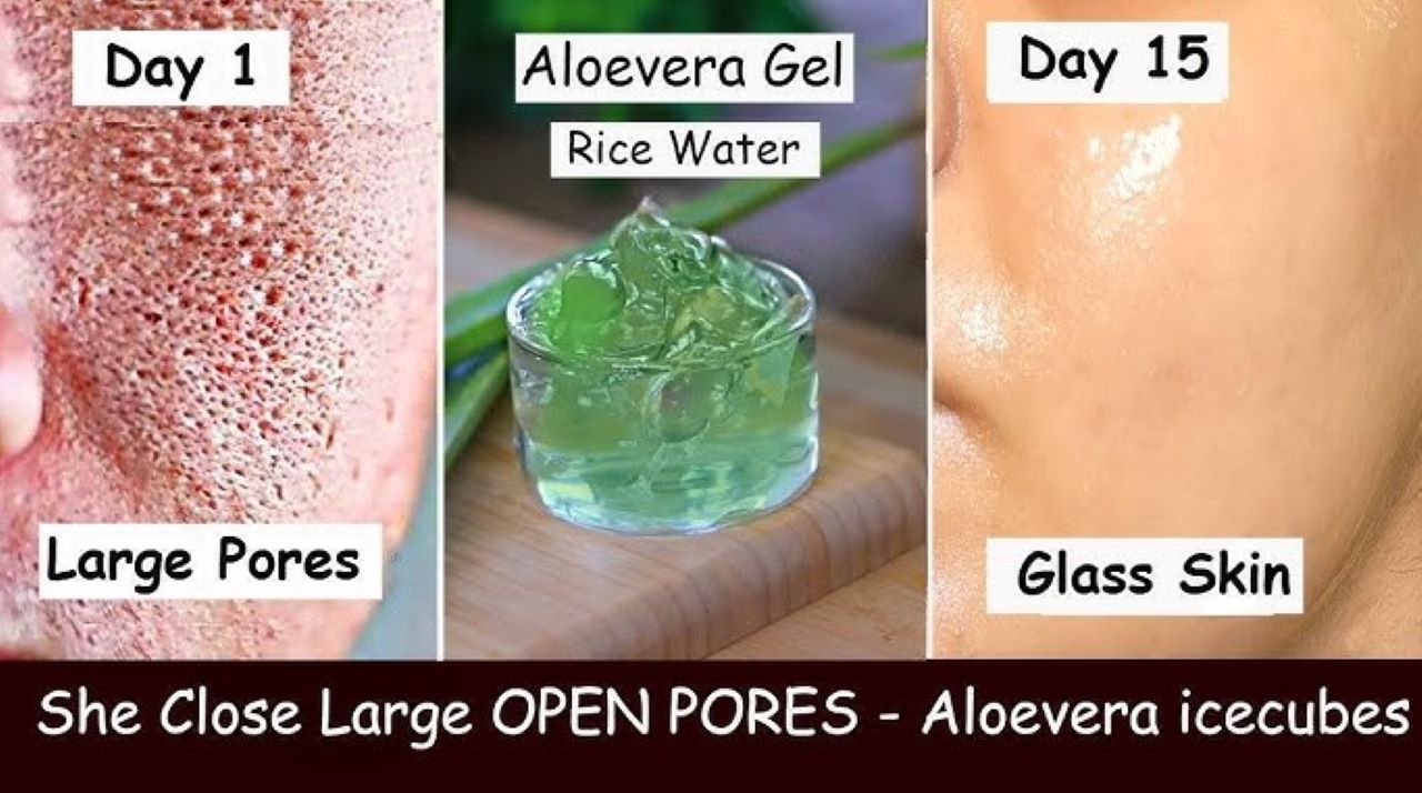 Cara Pakai Lidah Buaya untuk Mengecilkan Pori-Pori Terbuka, Modal 2 ...